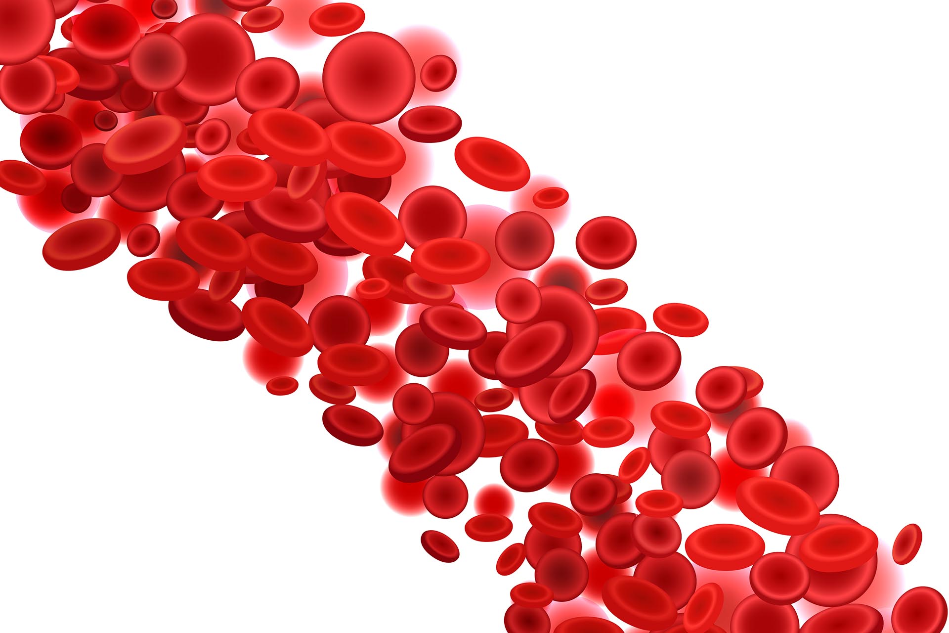 Angiologjia - Varicet - Venat varikoze - Trajtimi i Variceve